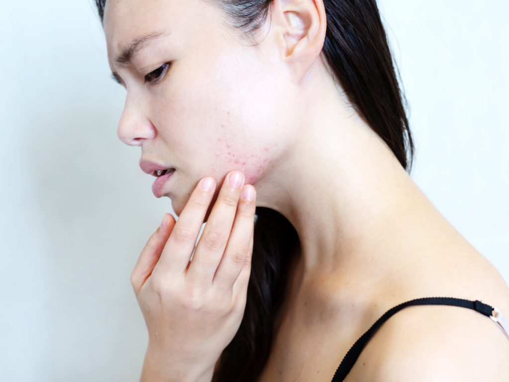 How to Treat Dull Skin - Free Bunni